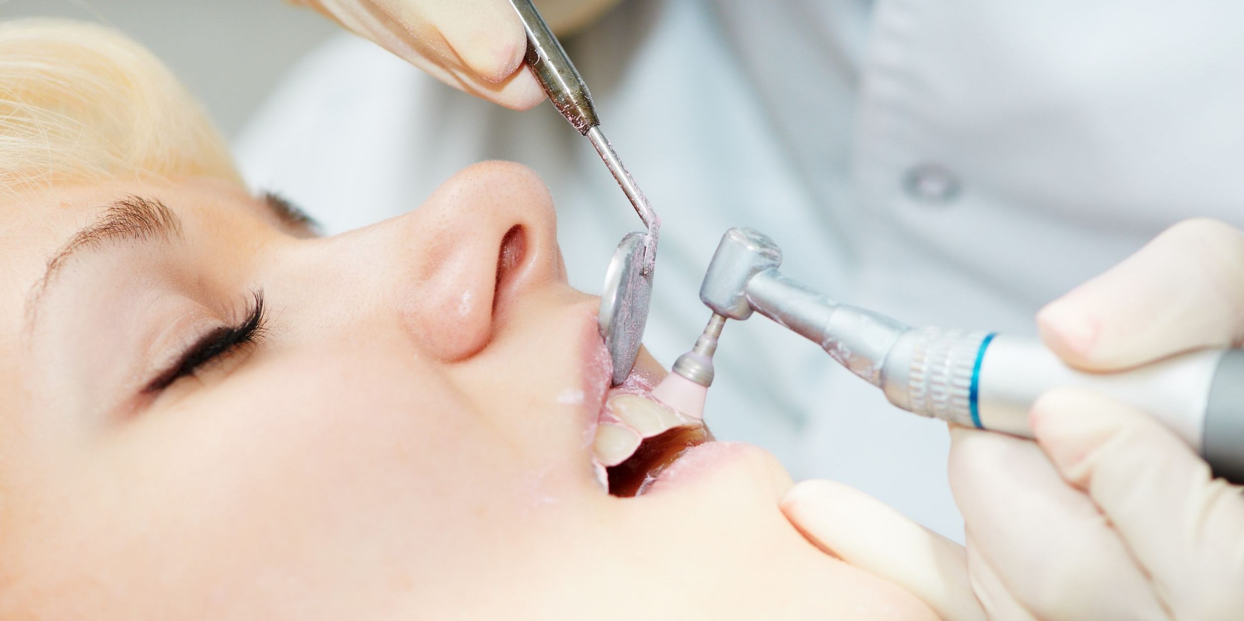 Profilaxia - Odontologia