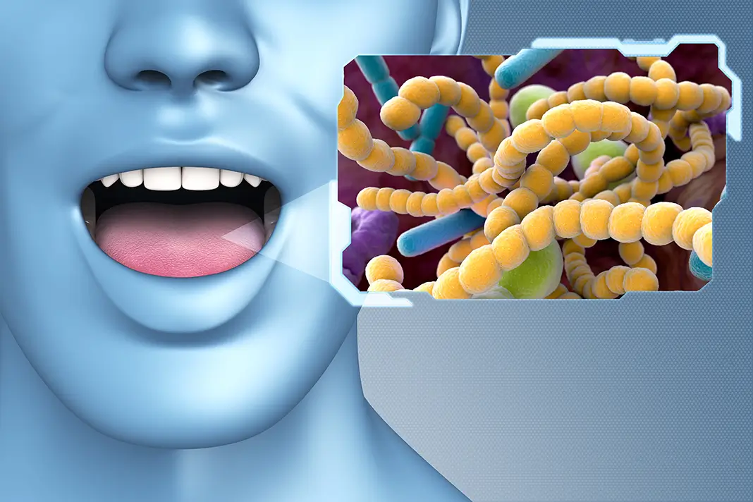 Microbioma Oral: Impactos da Flora Bucal na Saúde Sistêmica - Odontologia